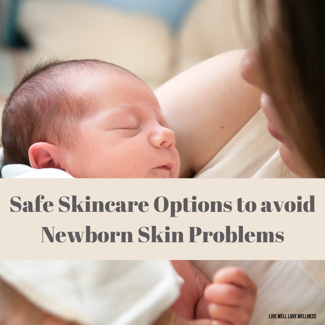 Safe Skincare Options to avoid Newborn Skin Problems - LIVE WELL LOVE ...